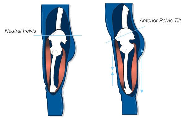 A Real Pain In The Butt: How To Treat 'Sit Bone' Pain | Ascent Chiropractic